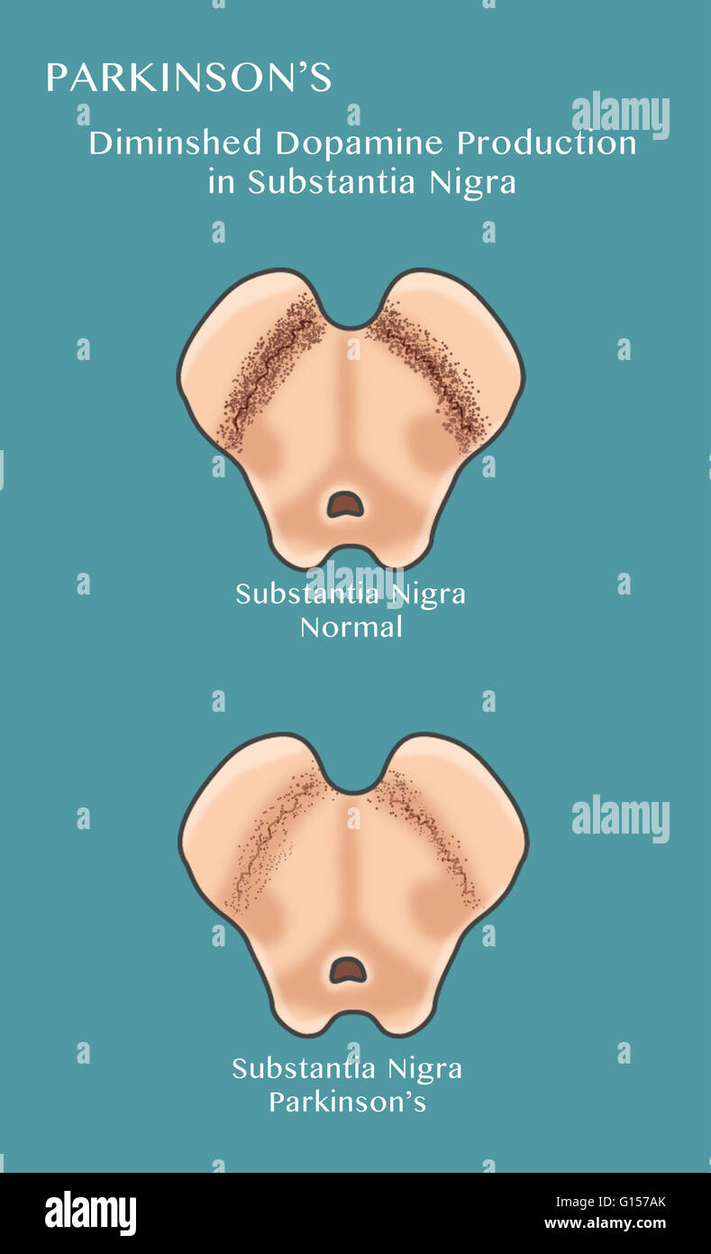 Substantia nigra hi-res stock photography and images - Alamy