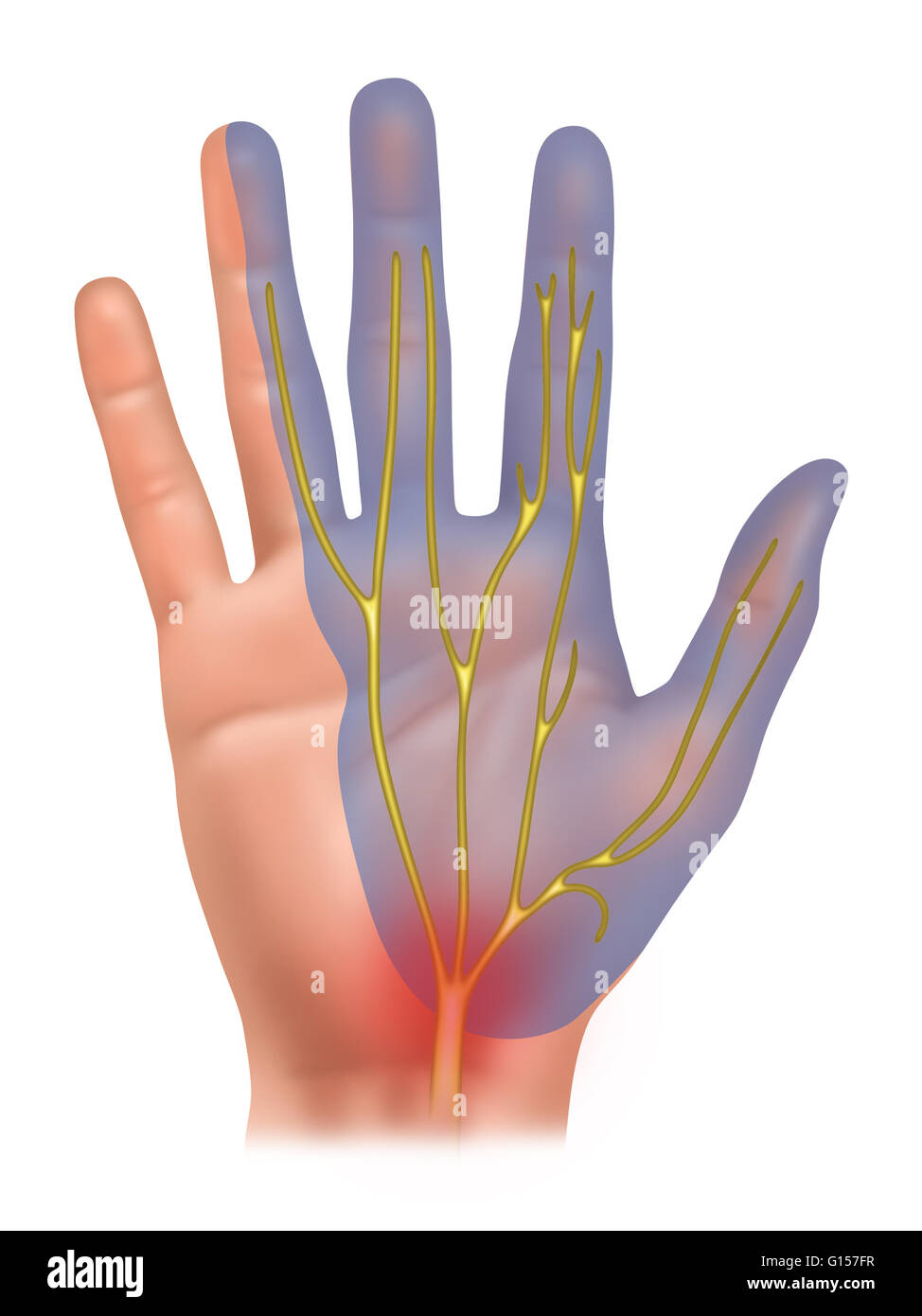 Median Nerve Hand