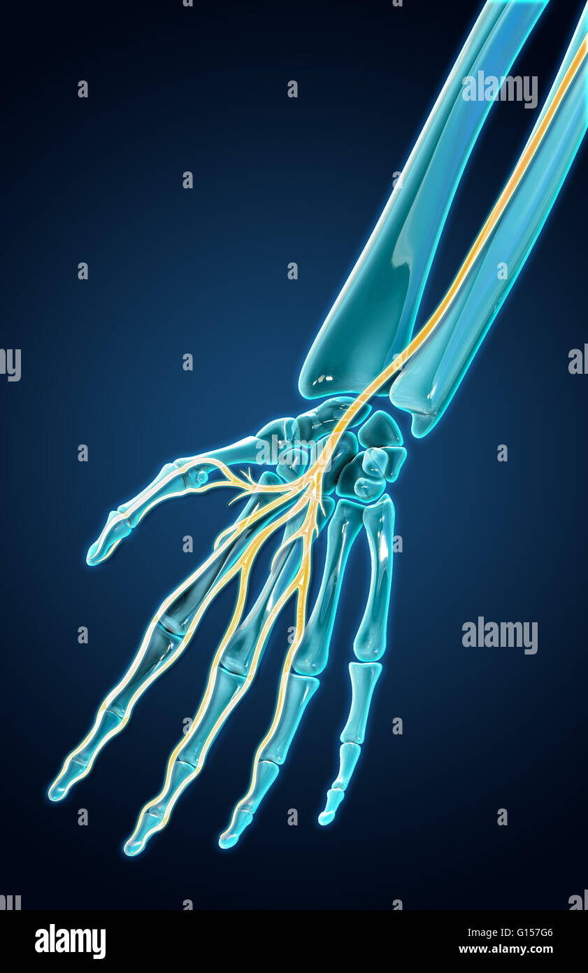 Median Nerve Mri Wrist