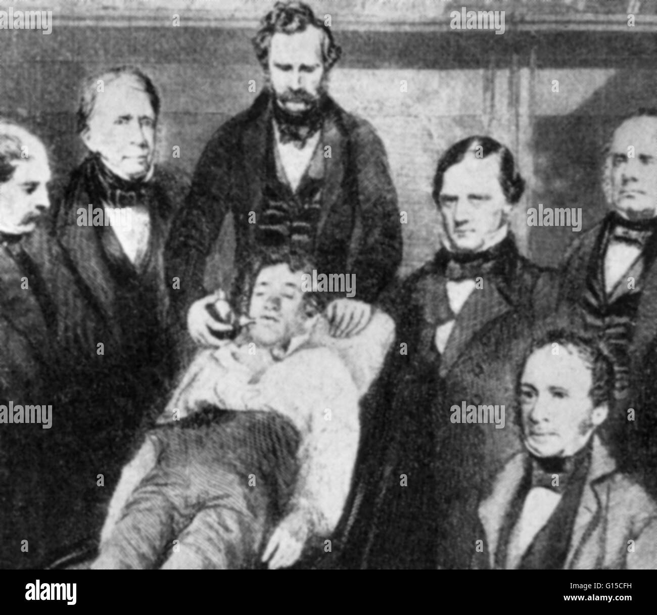 First use of surgical anesthesia. The first public demonstration of ...