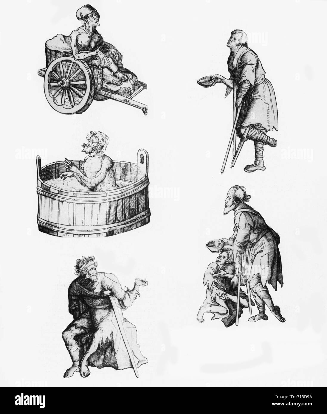 Leprosy disease hi-res stock photography and images - Alamy