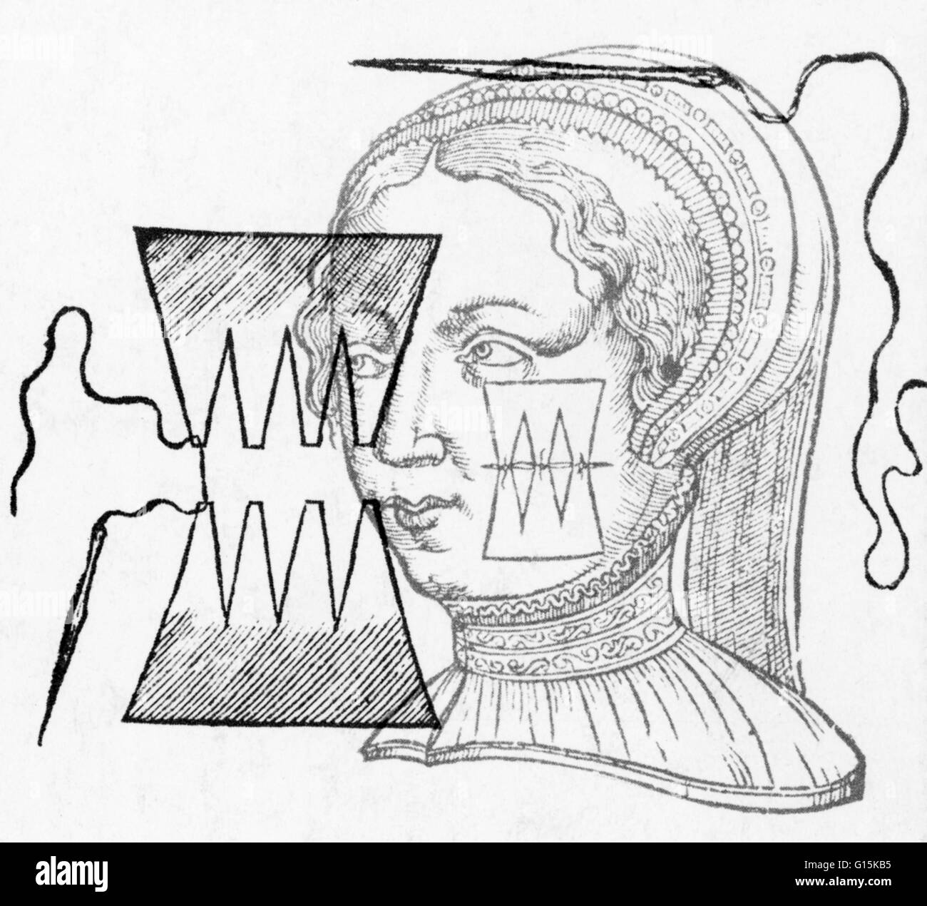 Surgical suture patient wound Black and White Stock Photos & Images - Alamy