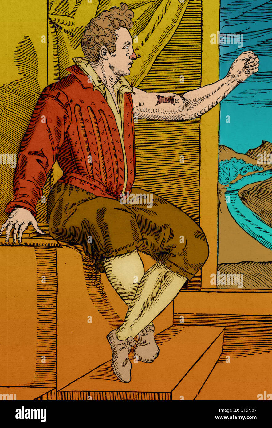 One of Gaspare Tagliacozzi's methods for replacing a missing nose. Here ...