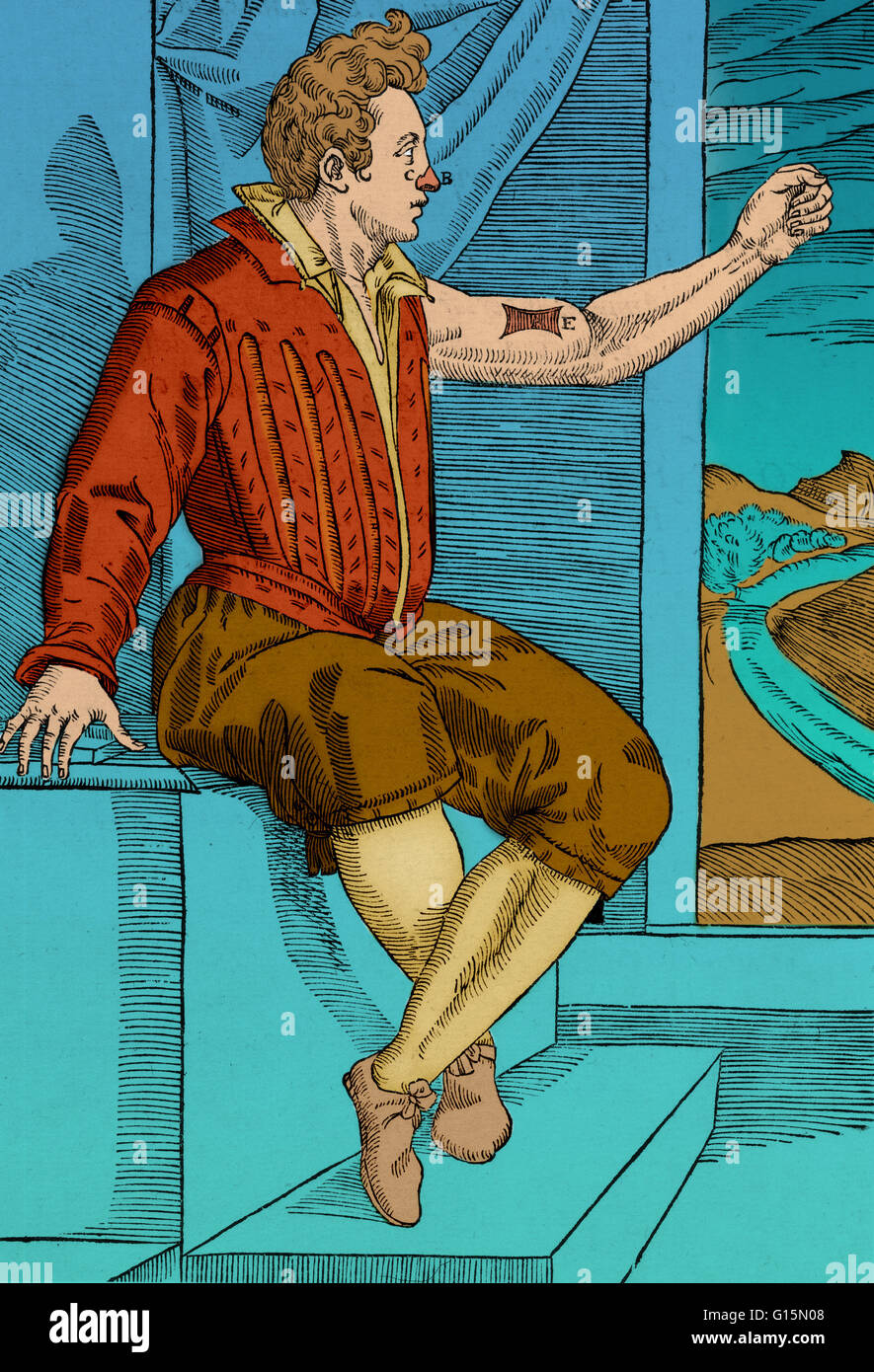 One of Gaspare Tagliacozzi's methods for replacing a missing nose. Here ...