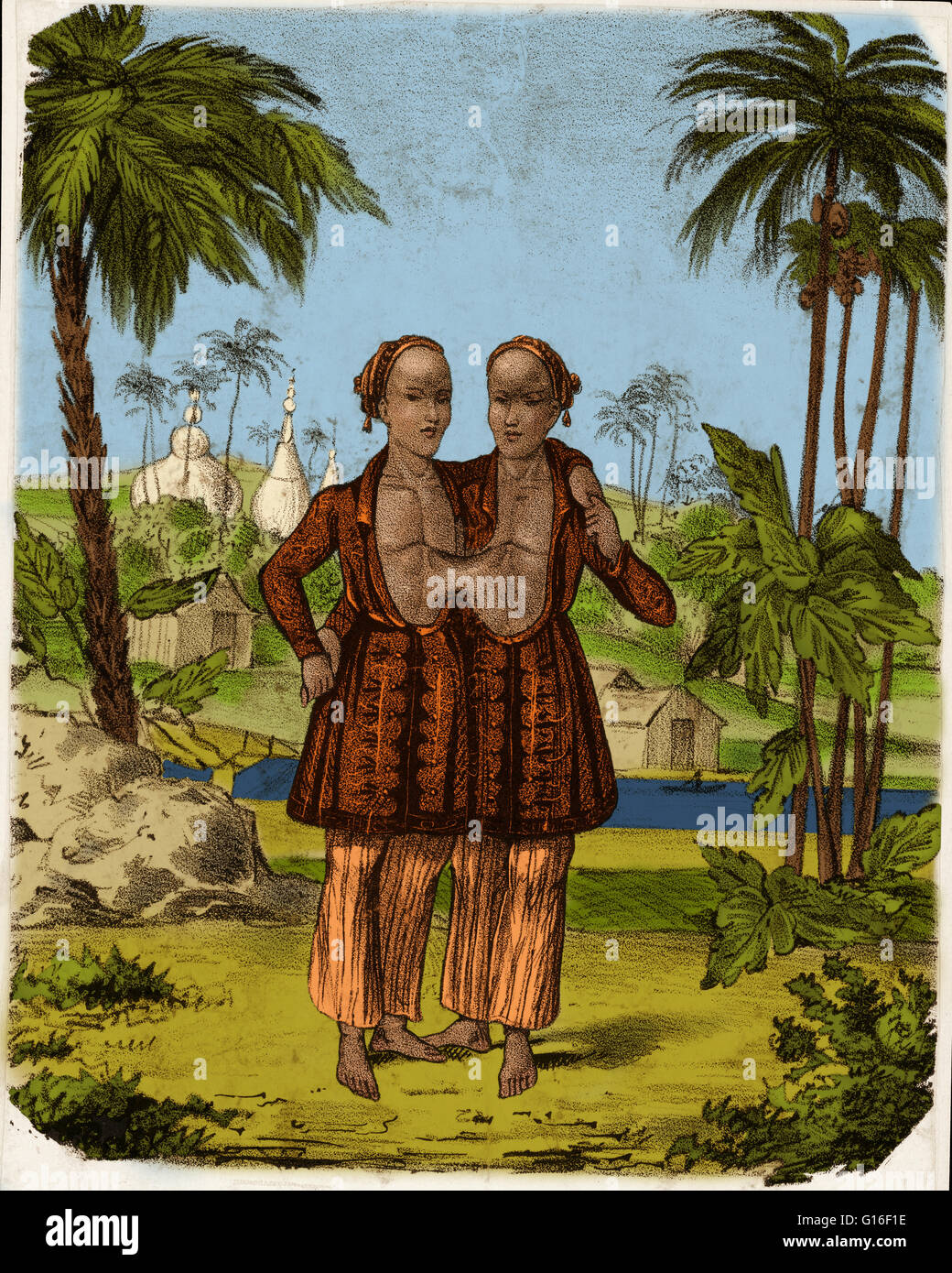 Chang and Eng (1811-1874) were conjoined twin brothers whose condition ...