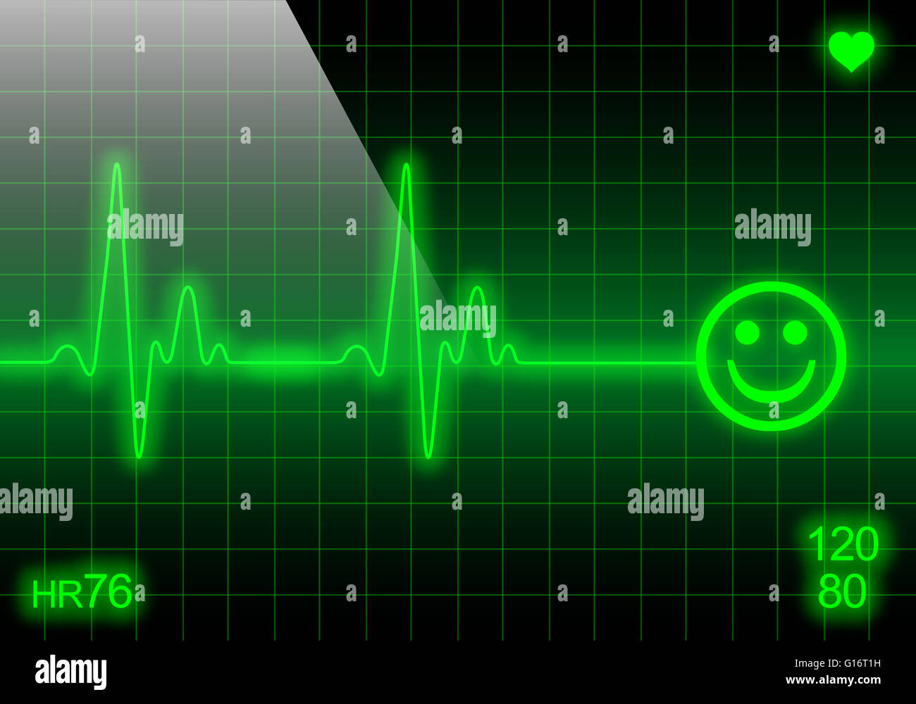 Smiley face on green heart rate monitor expressing excellent heart ...