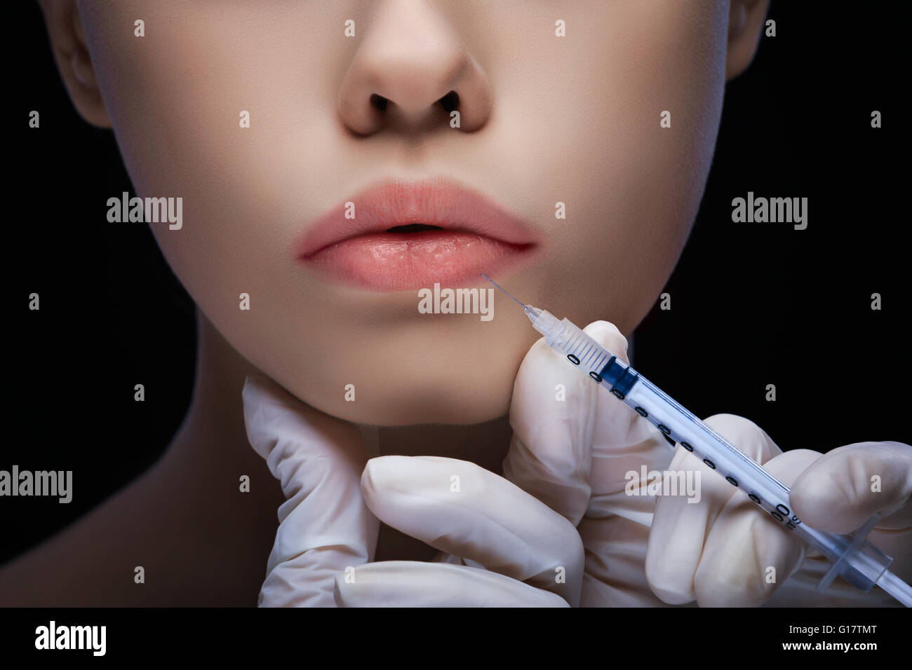Detailled close up view of a lip injection Stock Photo - Alamy