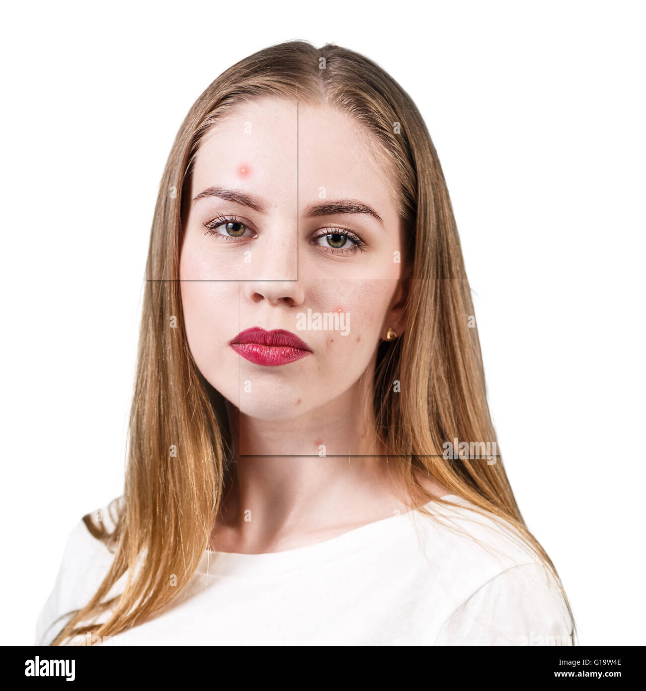 Frames with problem skin on beautiful woman face isolated on white ...