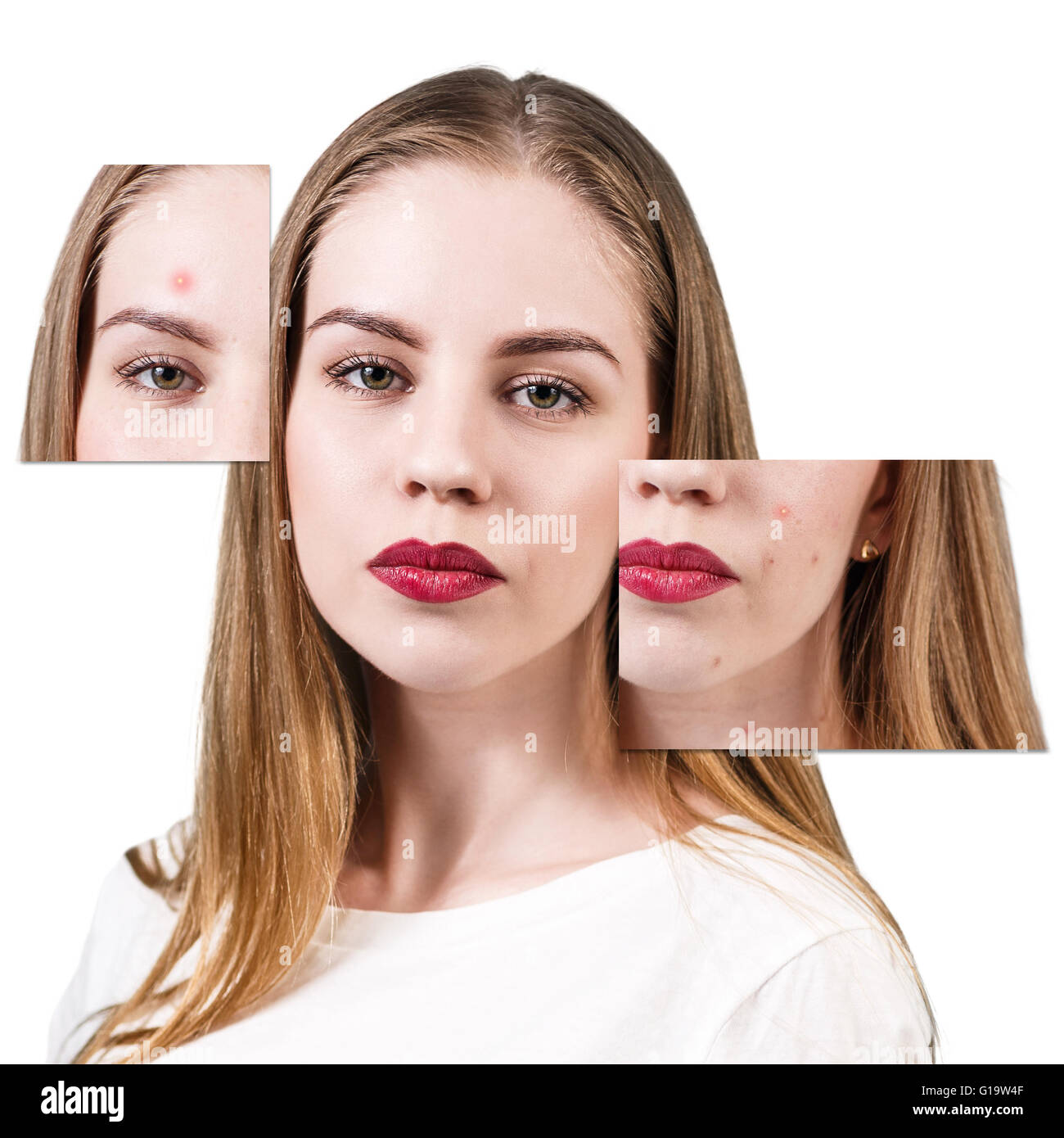 Frames with problem skin on beautiful woman face isolated on white ...