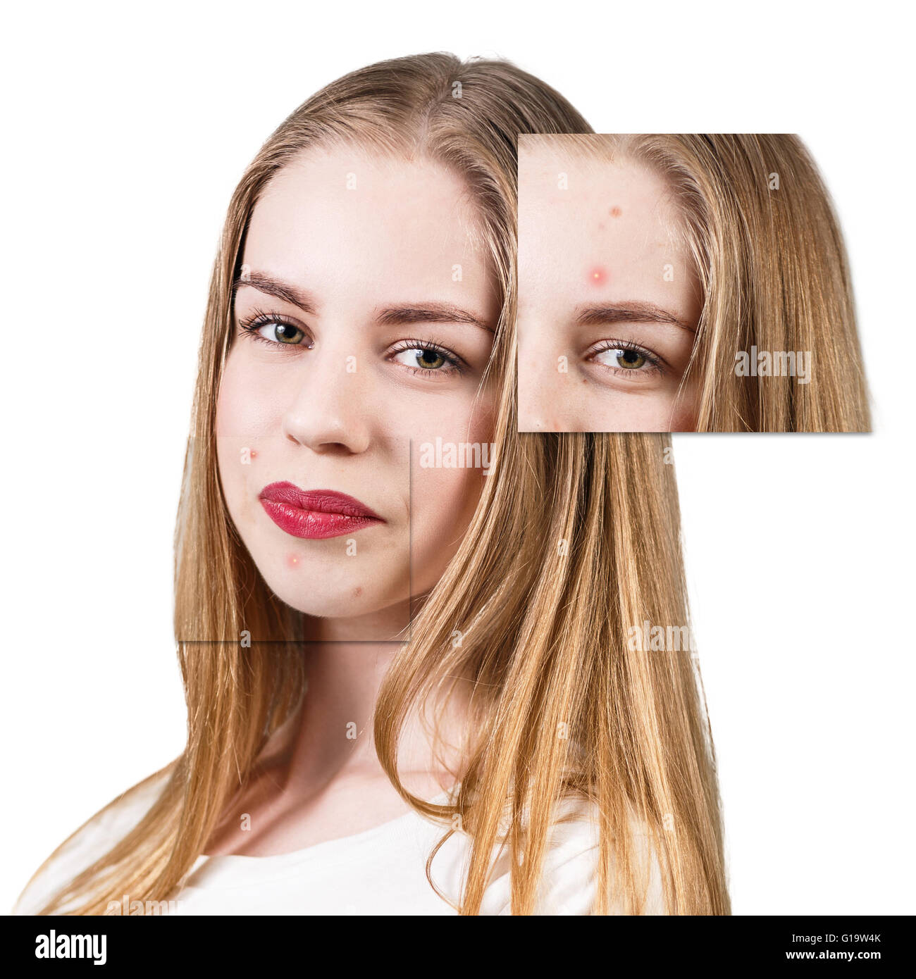 Frames with problem skin on beautiful woman face isolated on white ...