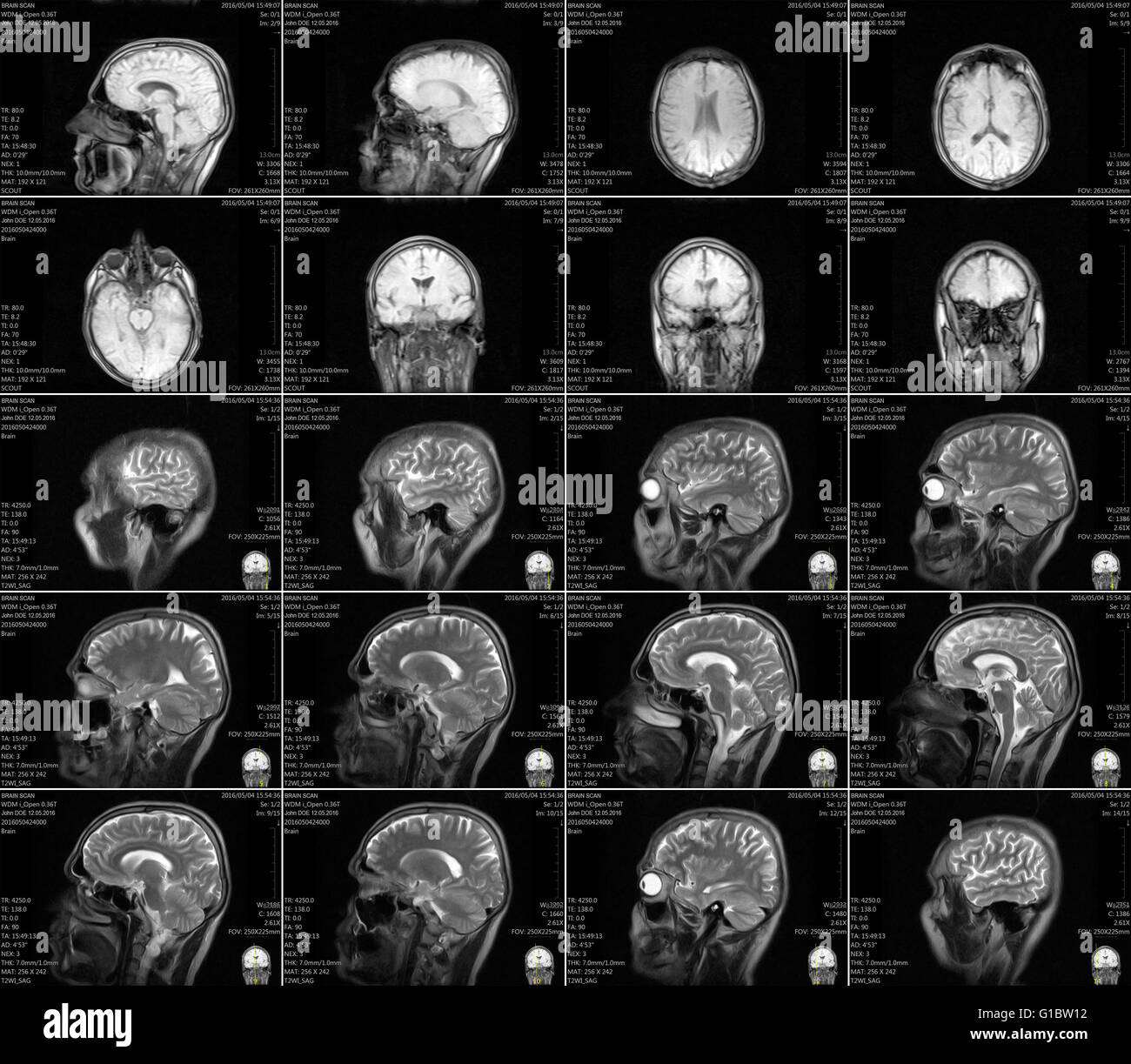 Health Scans Anatomy Radiology High Resolution Stock Photography and ...