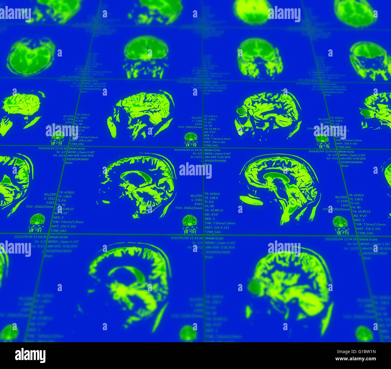 Brain neurons ct scan hi-res stock photography and images - Alamy