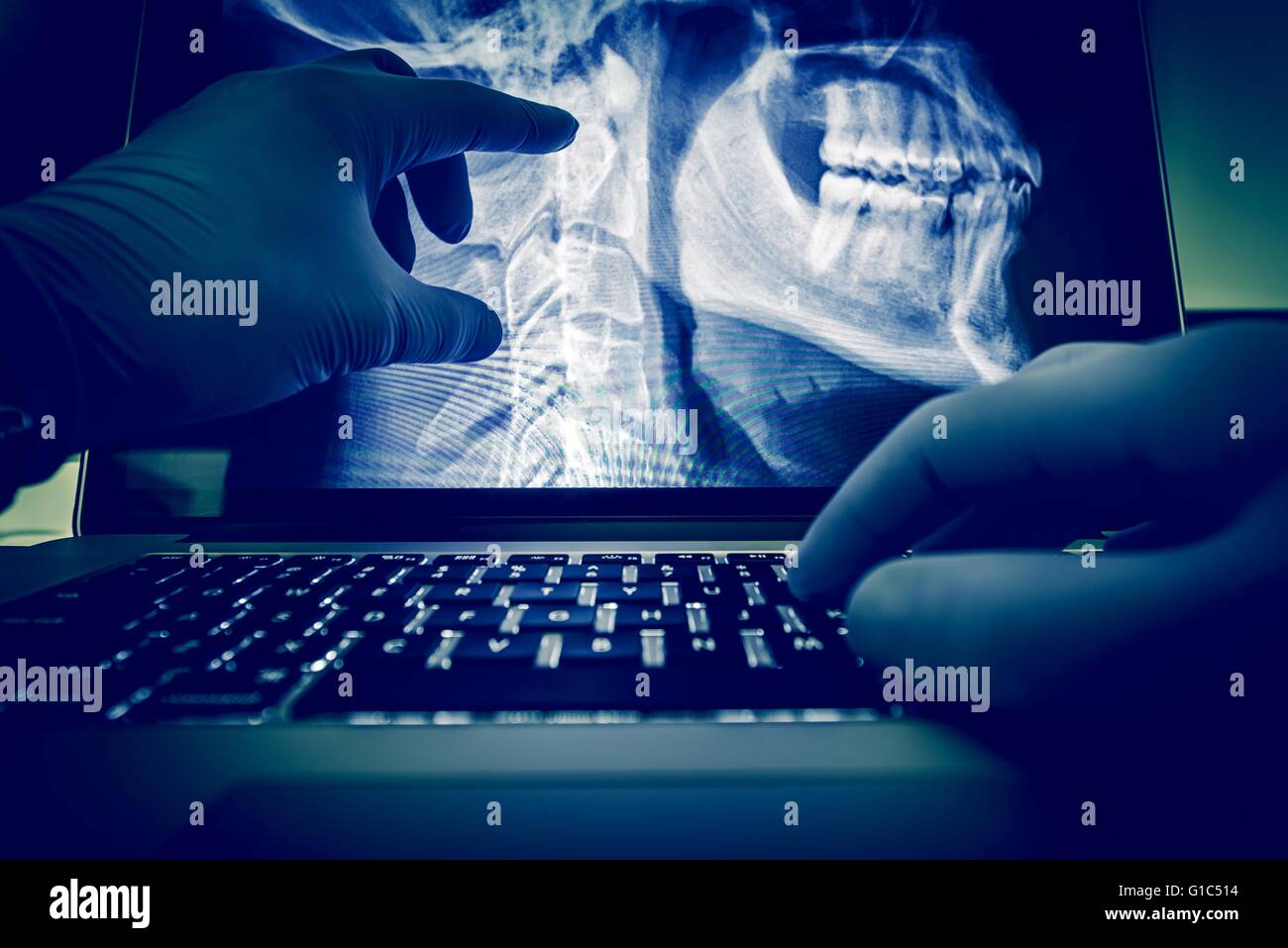 Doctor Examining Spine and Head X Ray Scan Images on His Laptop ...