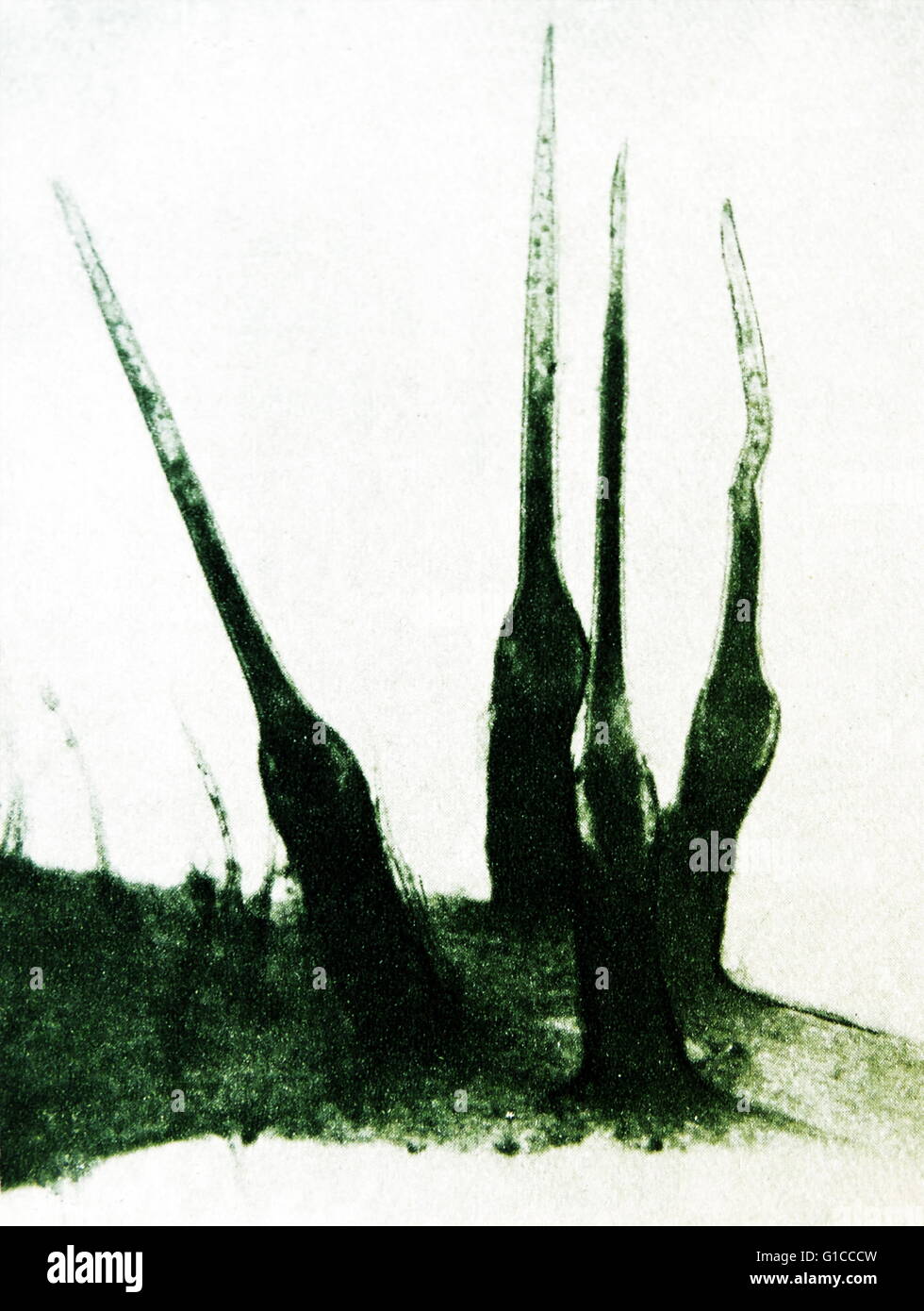 Human hair under microscope hi-res stock photography and images - Alamy