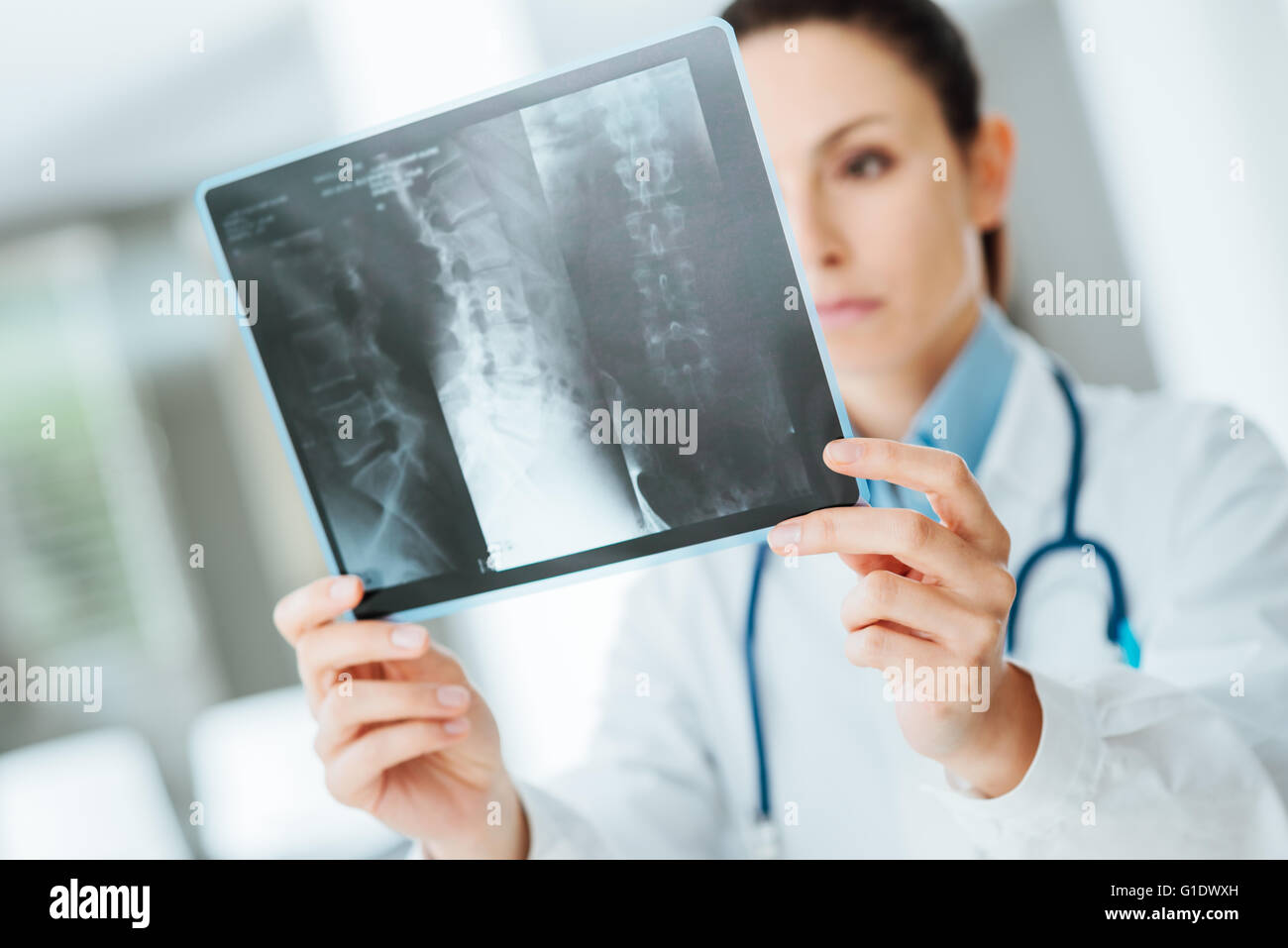 Young professional female doctor examining patient's x-ray of human ...