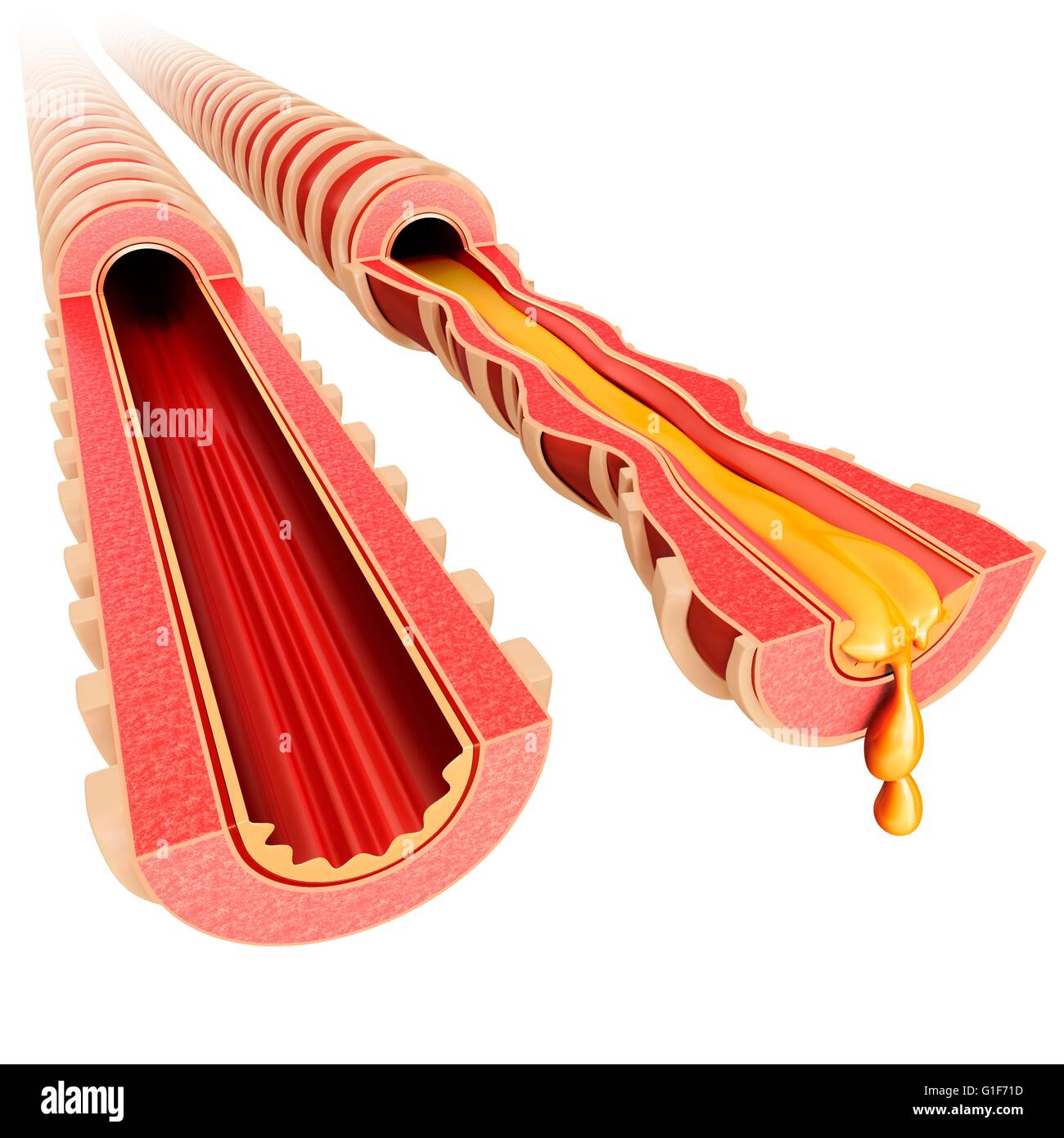 Bronchus hi-res stock photography and images - Alamy