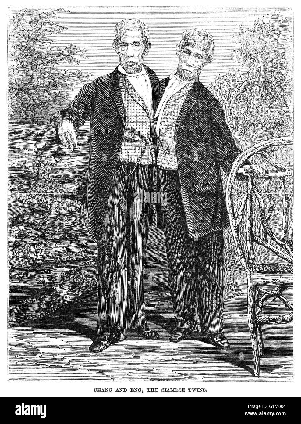 CHANG AND ENG (1811-1874). Thai-American conjoined twins and the origin ...