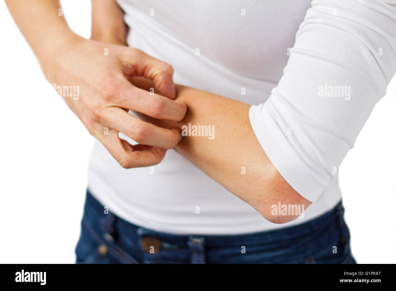 Atopic dermatitis women hi-res stock photography and images - Alamy