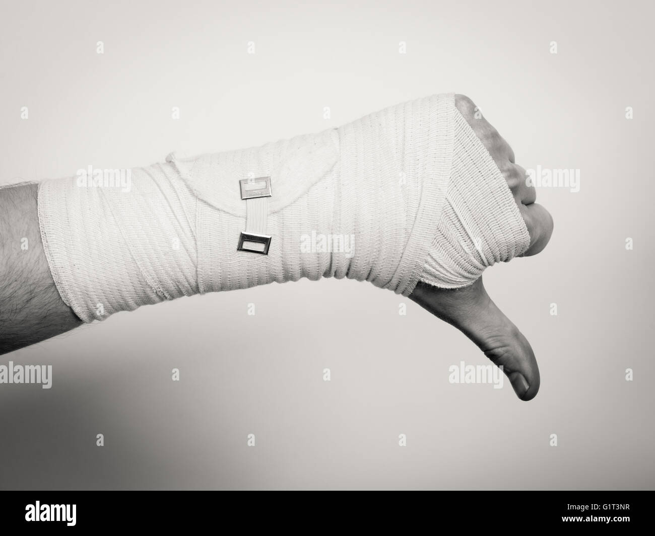 Broken thumb hi-res stock photography and images - Alamy