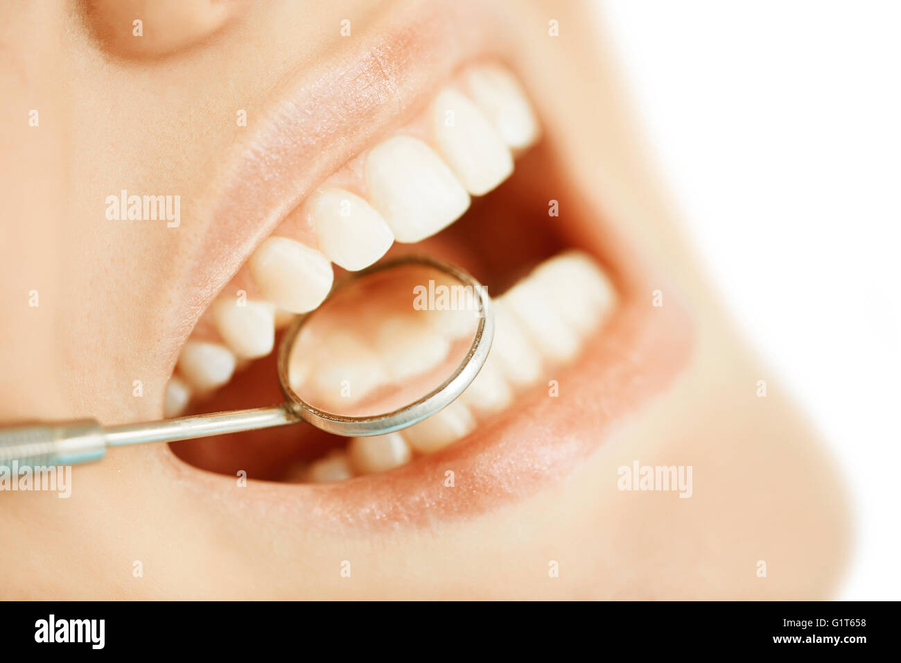 Oral health check hi-res stock photography and images - Alamy