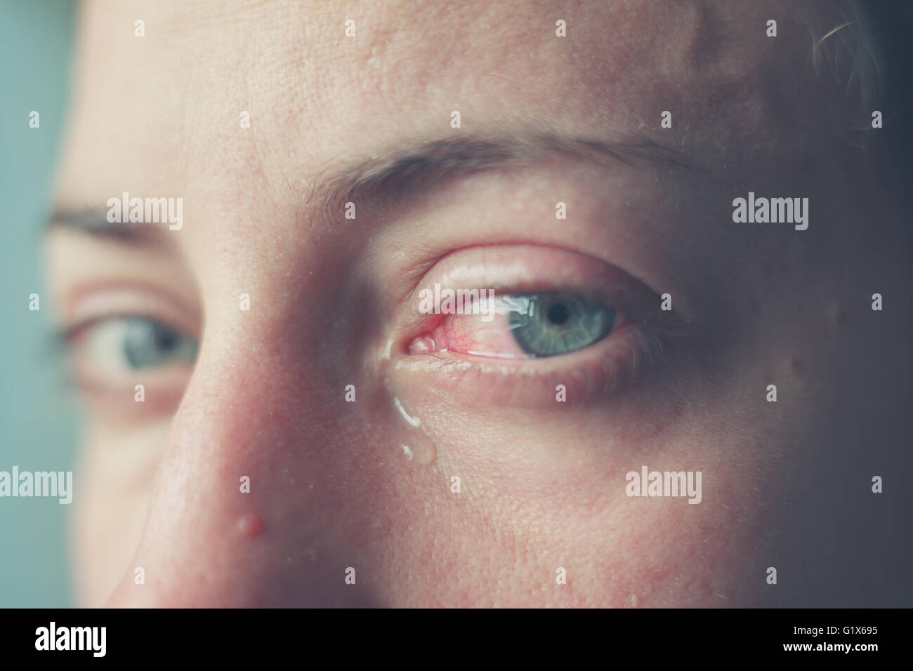 Bloodshot eye woman hi-res stock photography and images - Alamy