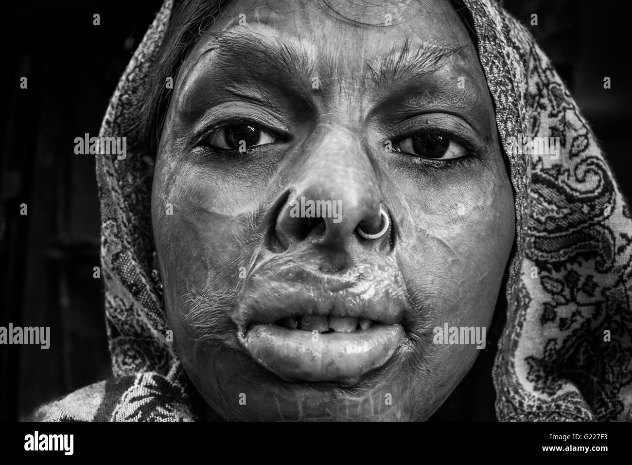 Scarred face hi-res stock photography and images - Alamy