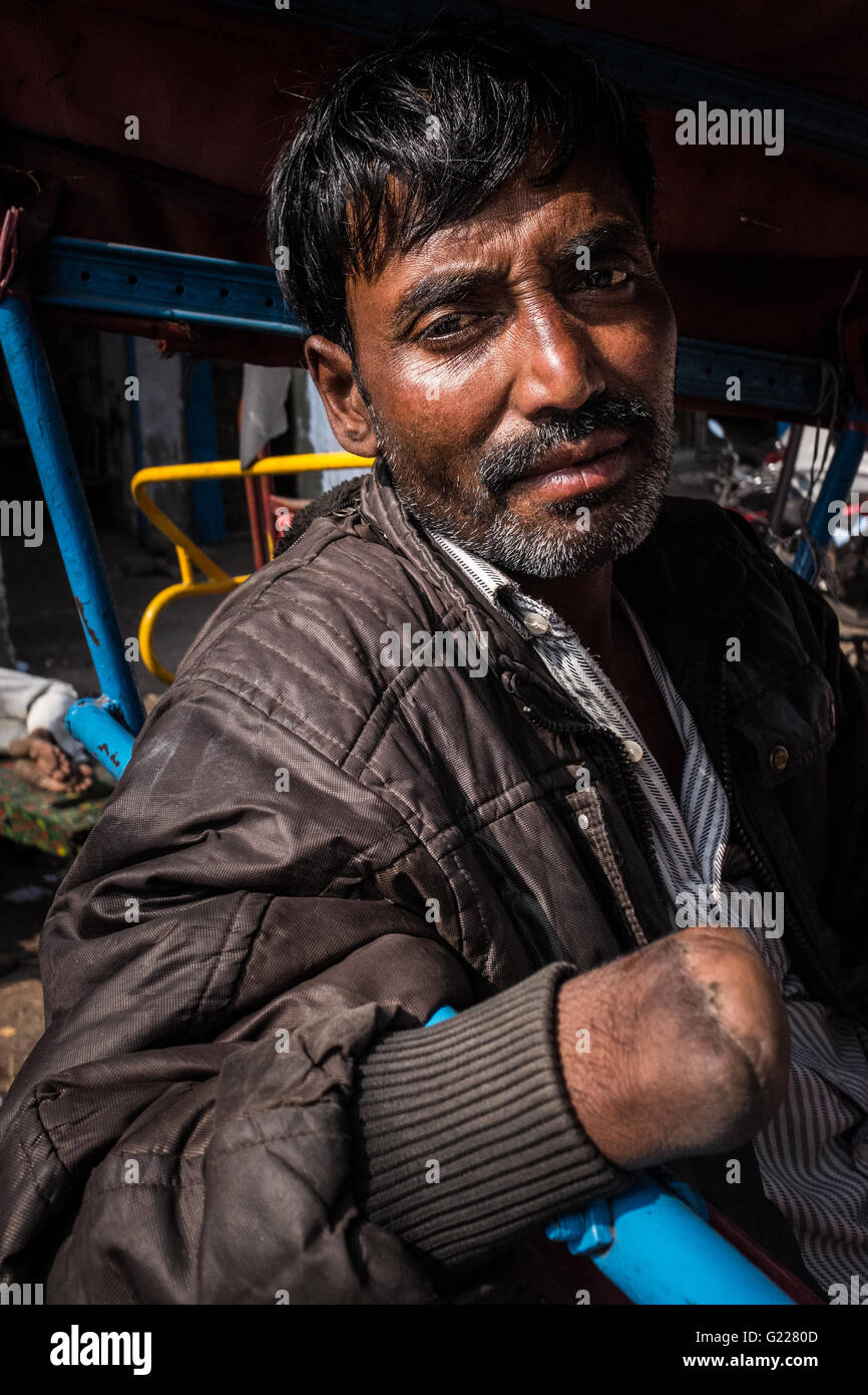 Male amputee hi-res stock photography and images - Alamy