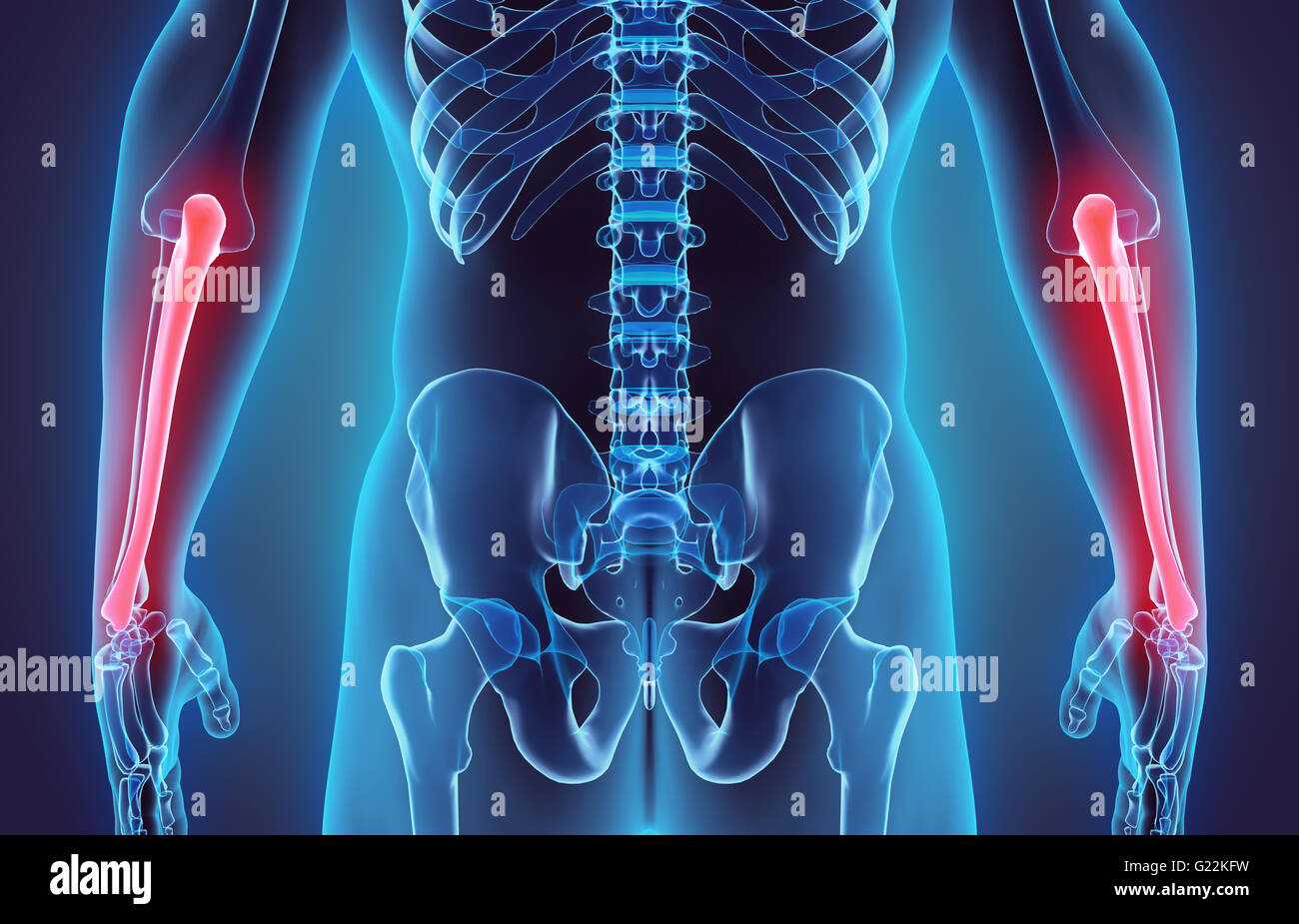 3D illustration of Ulna - Part of Human Skeleton Stock Photo - Alamy
