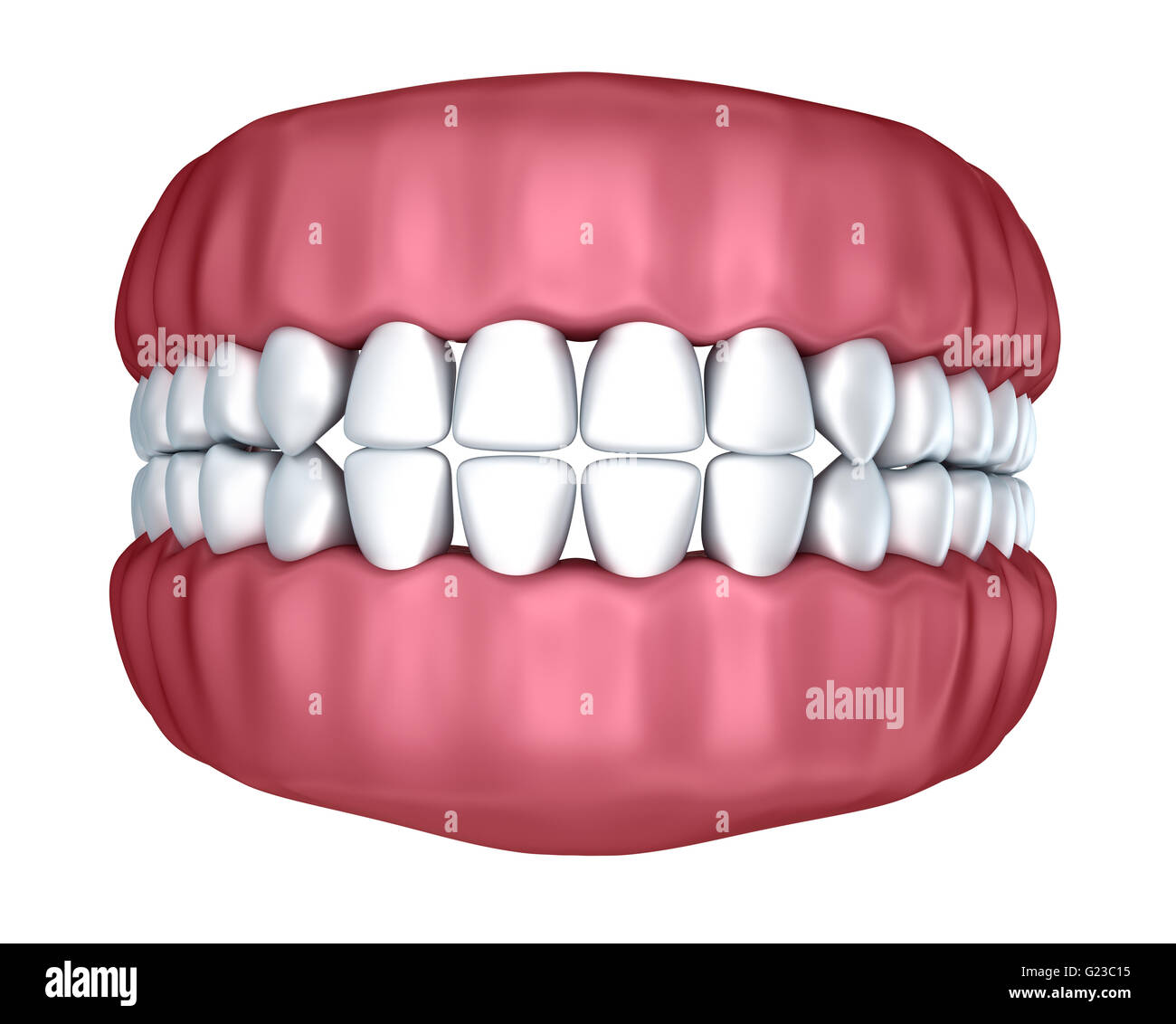 3d open denture isolated on hi-res stock photography and images - Alamy