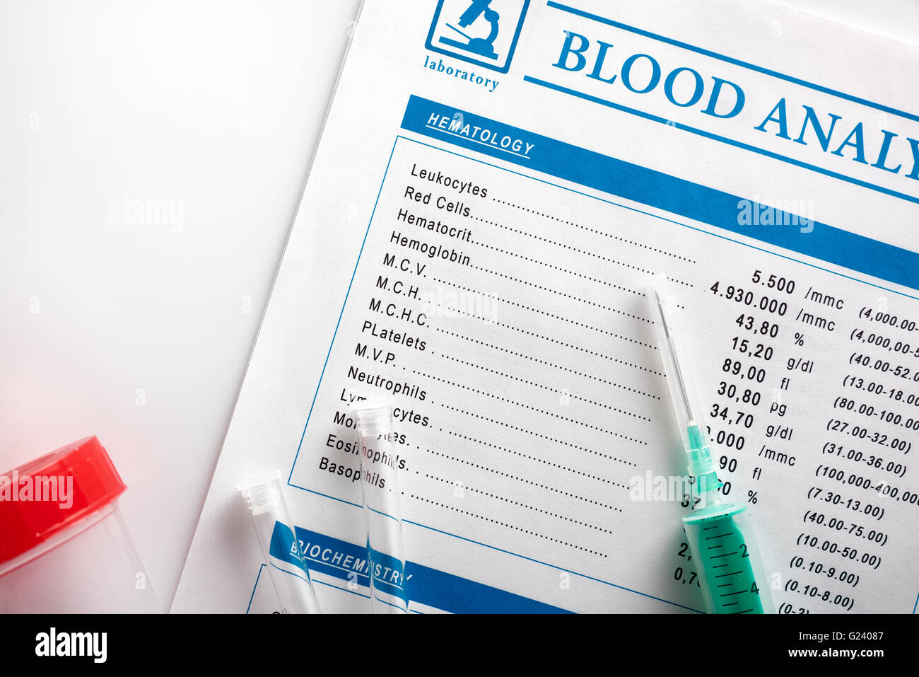 Blood test report with vials, urine container and syringe over white ...