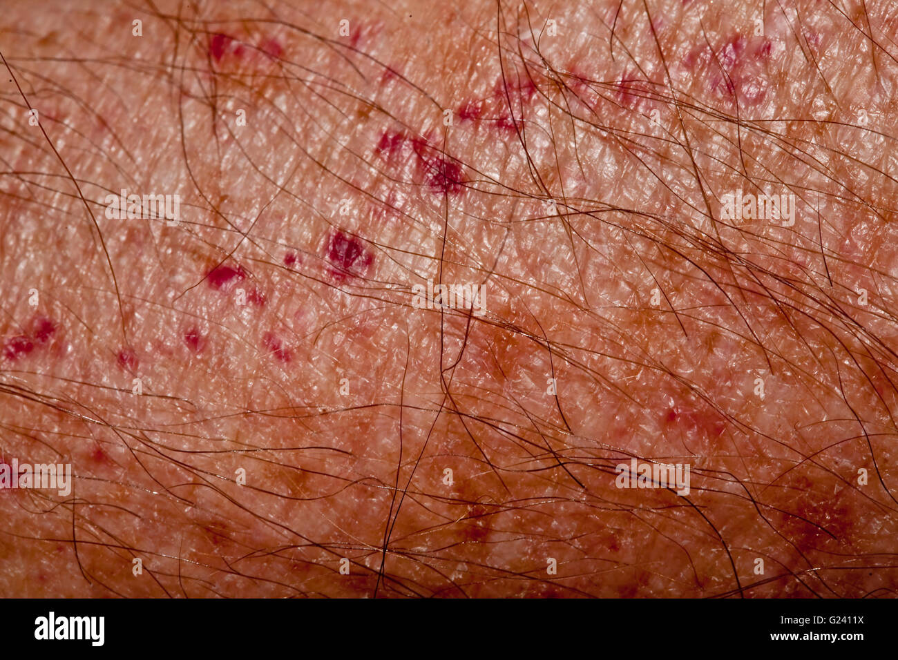 Blanch skin hi-res stock photography and images - Alamy