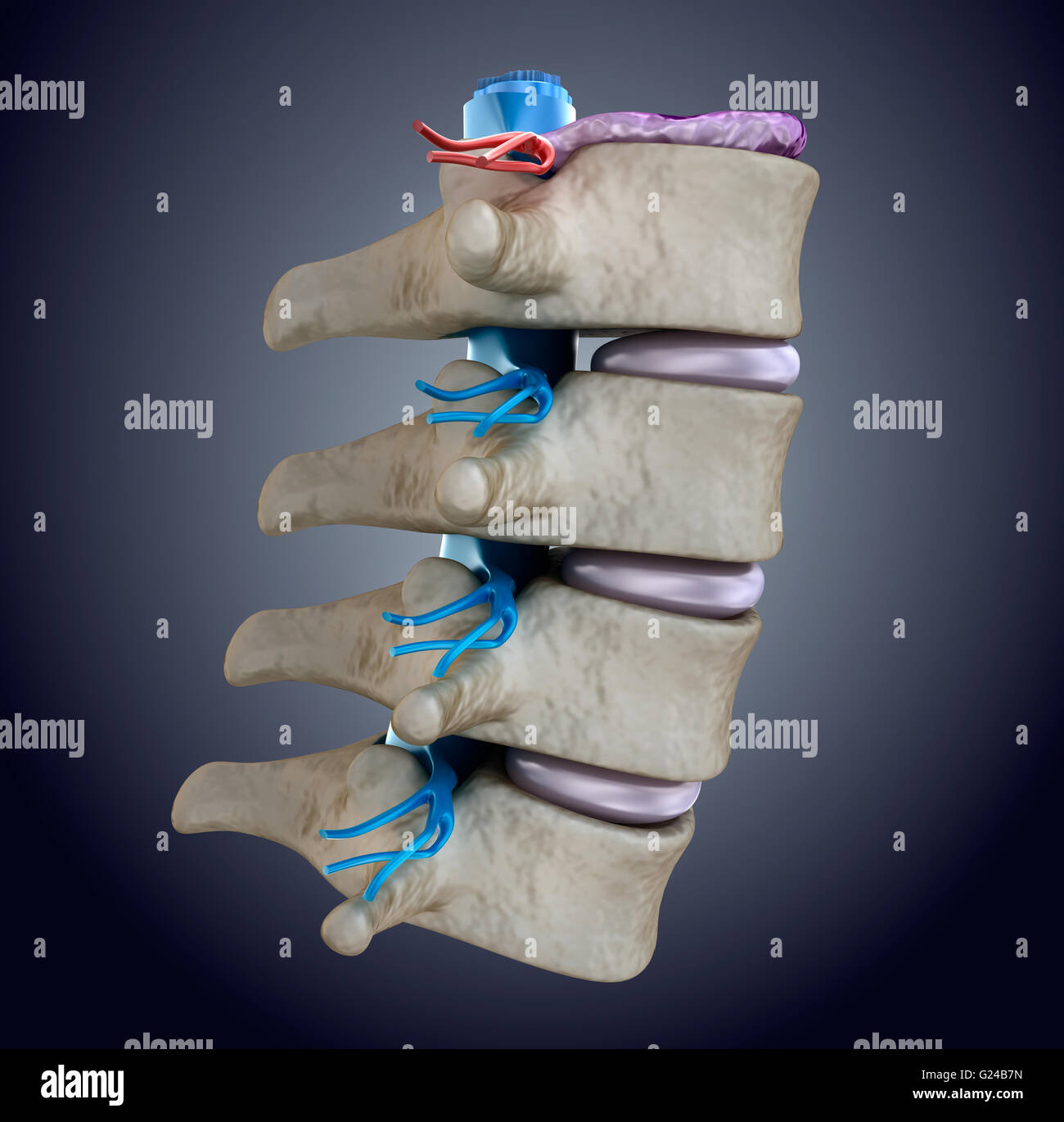 Disc Extrusion Stock Photos & Disc Extrusion Stock Images - Alamy