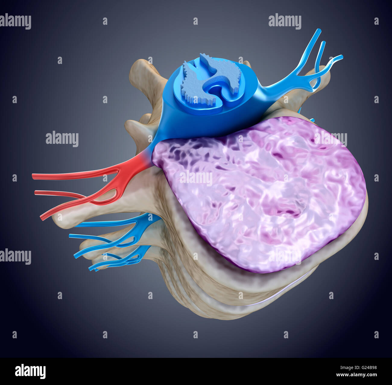 Disc extrusion hi-res stock photography and images - Alamy