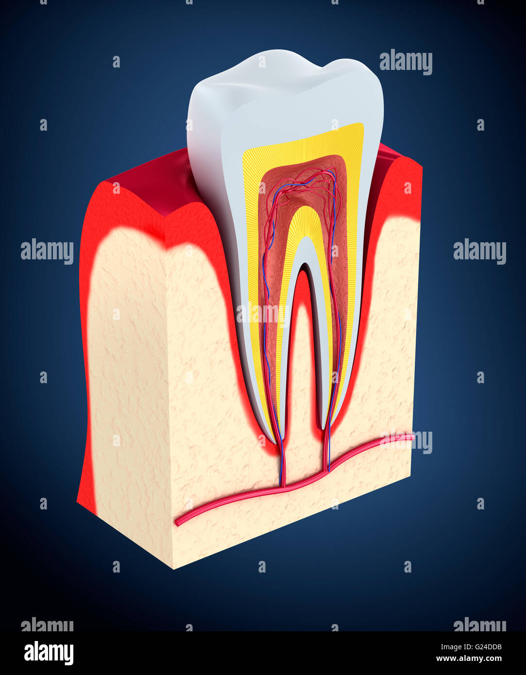 Section of the tooth. pulp with nerves and blood vessels Stock Photo ...