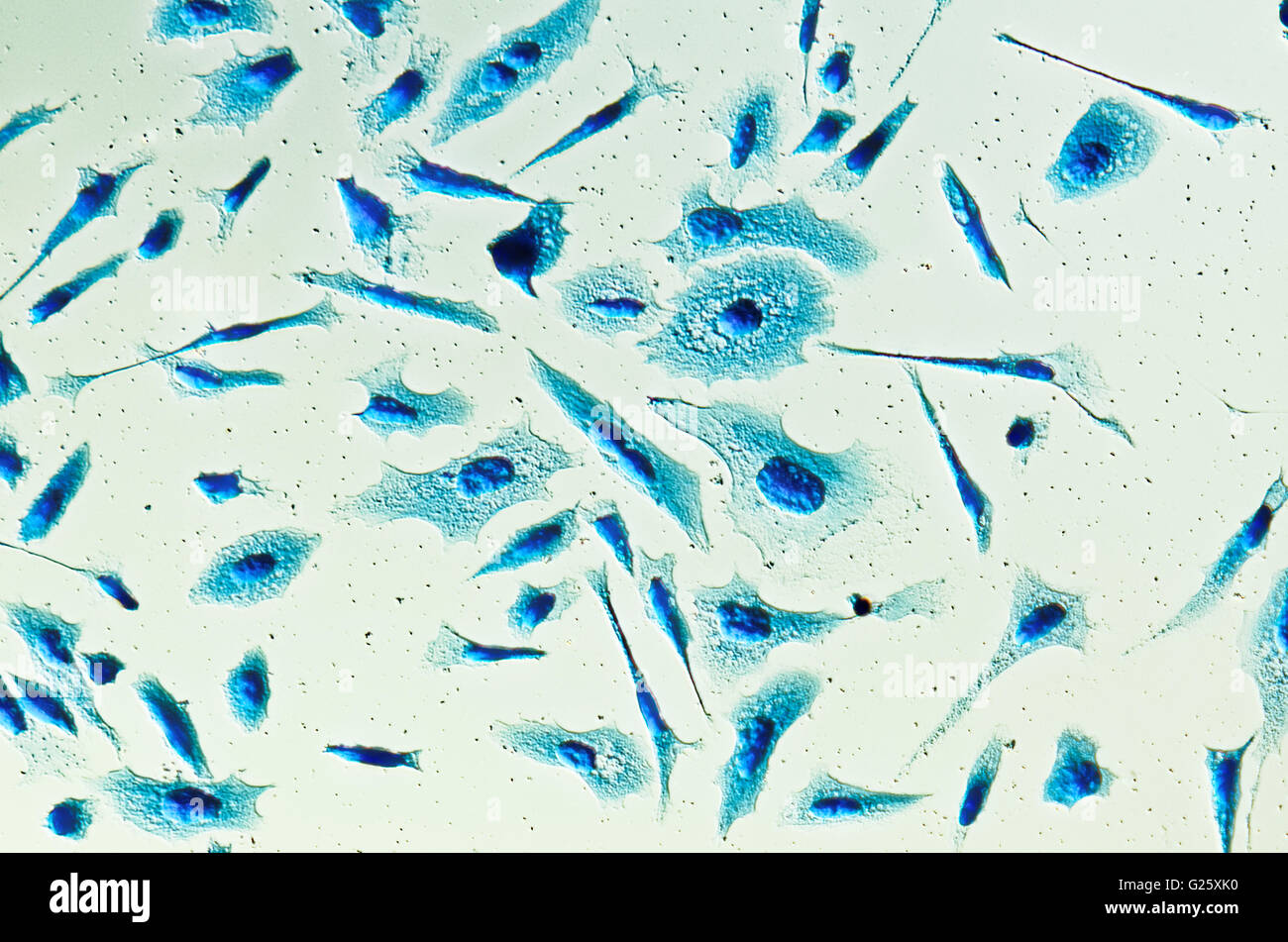 PC-3 human prostate cancer cells, stained with Coomassie blue, under ...
