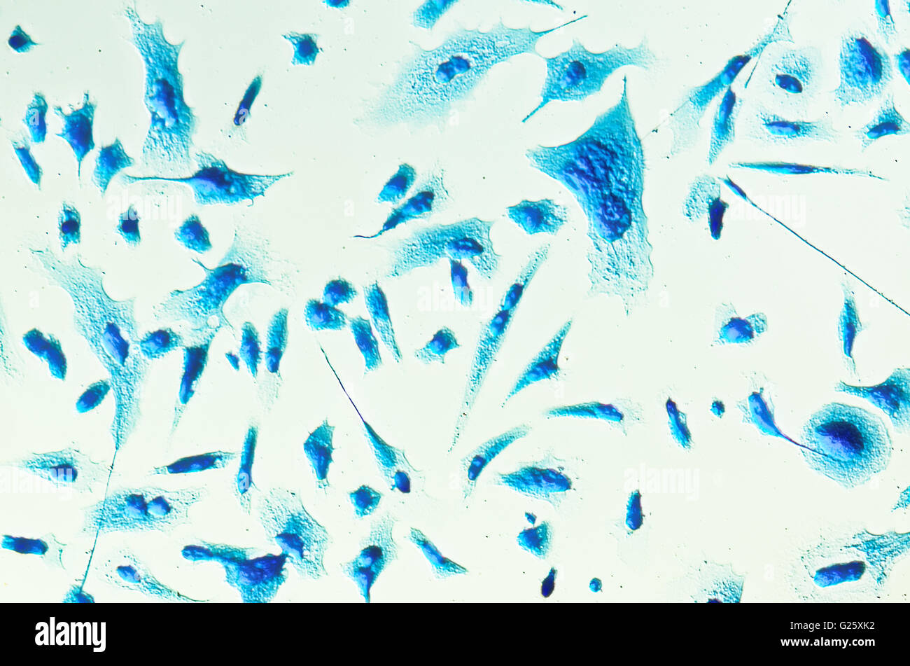 PC-3 human prostate cancer cells, stained with Coomassie blue, under ...