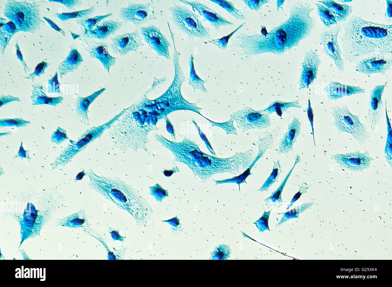 PC-3 human prostate cancer cells, stained with Coomassie blue, under ...