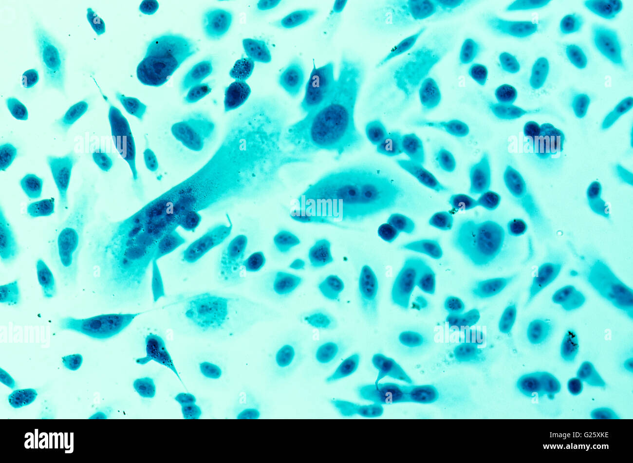 PC-3 human prostate cancer cells, stained with Coomassie blue, under ...