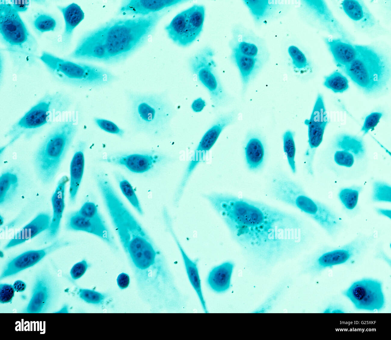 PC-3 human prostate cancer cells, stained with Coomassie blue, under ...