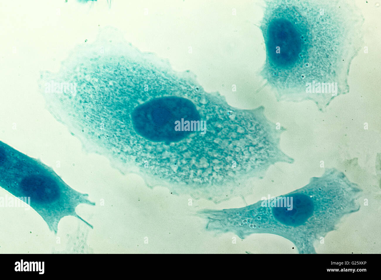 PC-3 human prostate cancer cells, stained with Coomassie blue, under ...