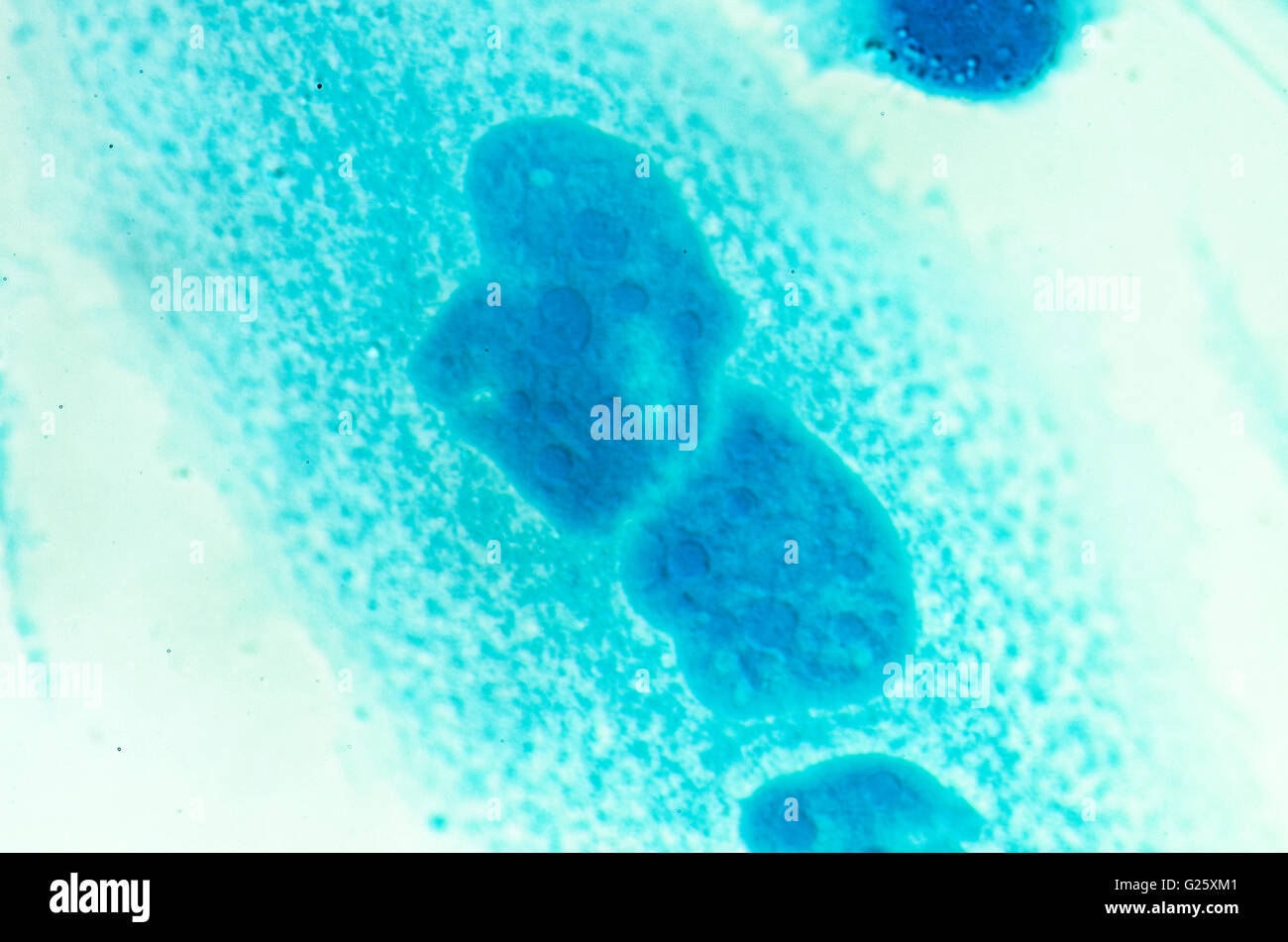 PC-3 human prostate cancer cells, stained with Coomassie blue, under ...