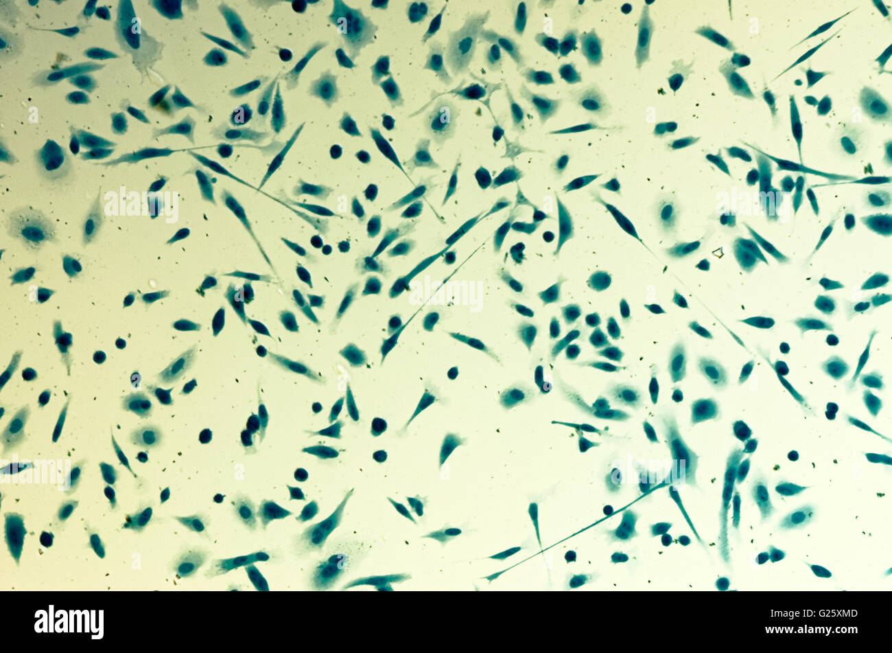 PC-3 human prostate cancer cells, stained with Coomassie blue, under ...