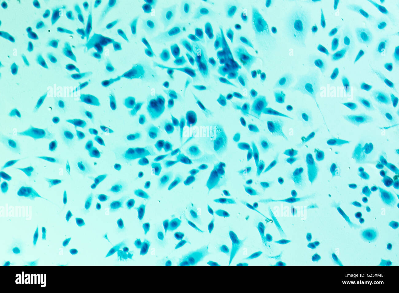 PC-3 human prostate cancer cells, stained with Coomassie blue, under ...