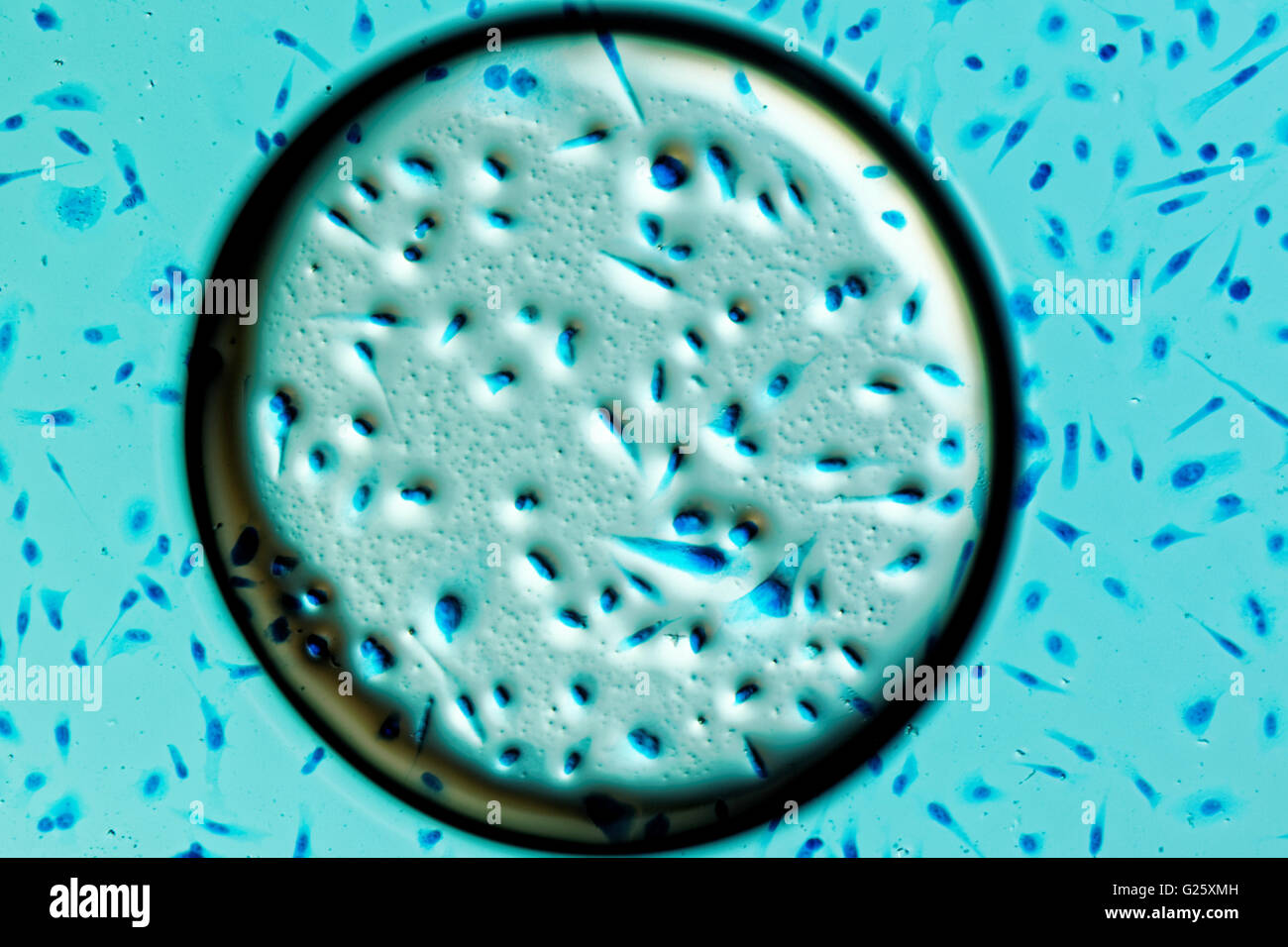 PC-3 human prostate cancer cells in air bubble, stained with Coomassie ...