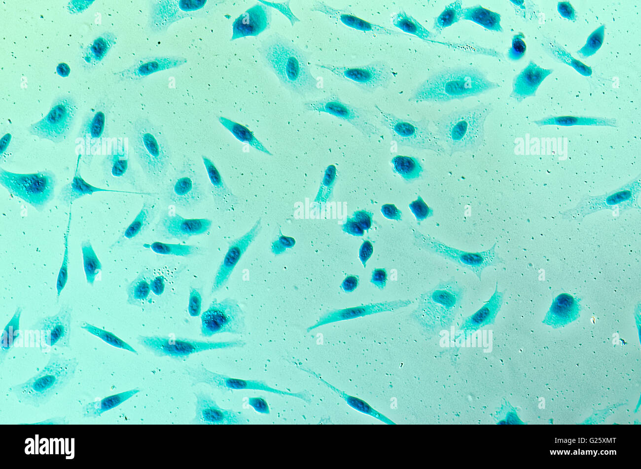 PC-3 human prostate cancer cells, stained with Coomassie blue, under ...