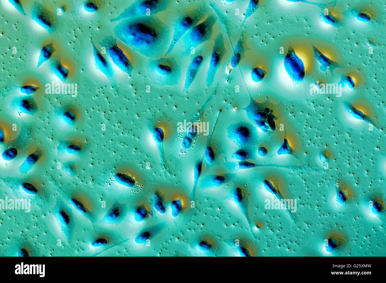 PC-3 human prostate cancer cells, stained with Coomassie blue, under ...