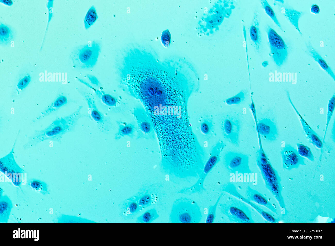 PC-3 human prostate cancer cells, stained with Coomassie blue, under ...