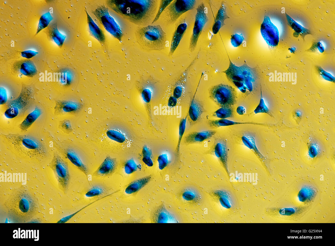 PC-3 human prostate cancer cells, stained with Coomassie blue, under ...