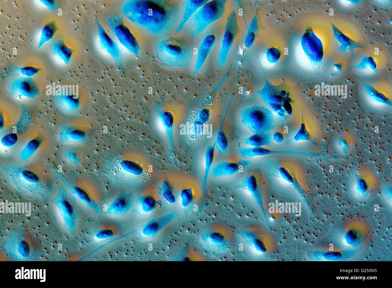 PC-3 human prostate cancer cells, stained with Coomassie blue, under ...