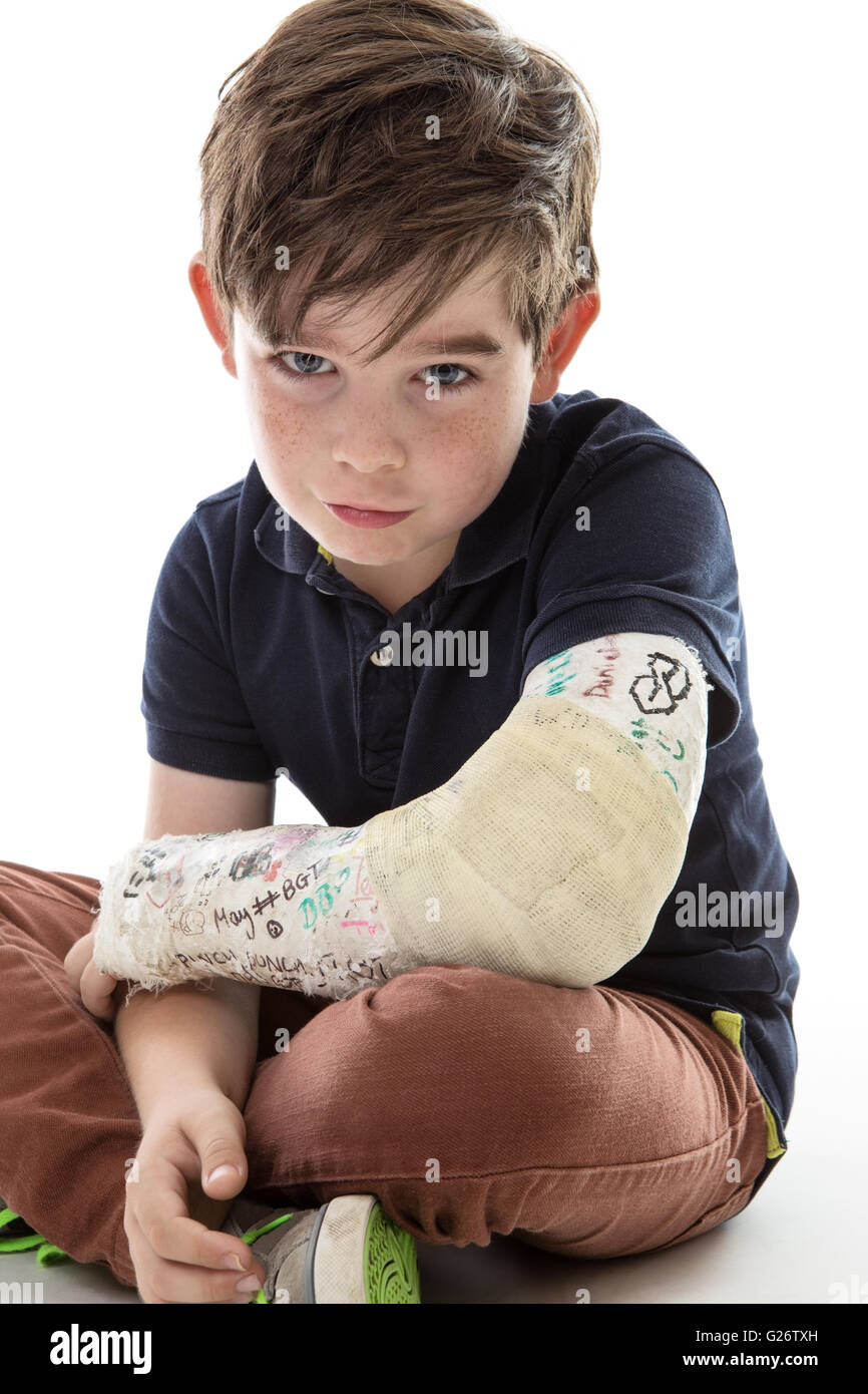 Left arm in plaster hi-res stock photography and images - Alamy